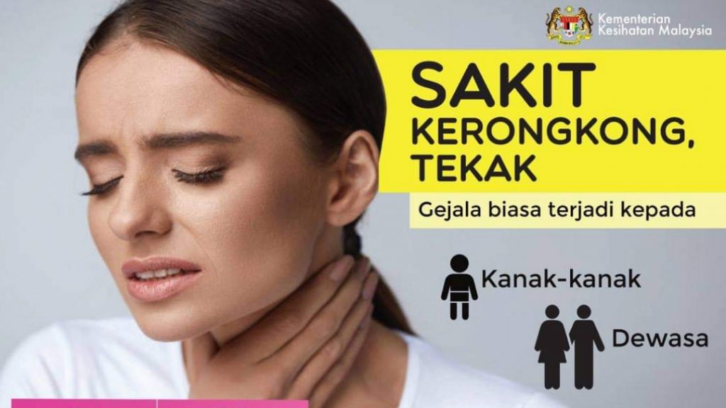 Doktor Kongsi 5 Cara Berkesan Kurangkan Sakit Tekak Di Rumah