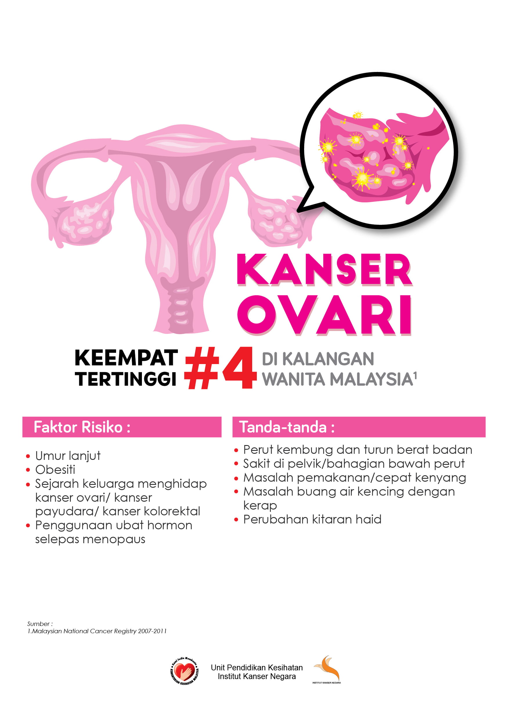 7 Tanda Awal Kanser Ovari Yang Digelar Pembunuh Senyap